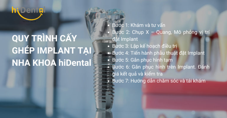 Quy Trình Cấy Ghép Implant hiDental - hiDental - Nha khoa Xin chào