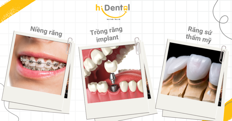 Nha khoa uy tín quận 7 – Khám phá trải nghiệm 5 sao tại hiDental ...